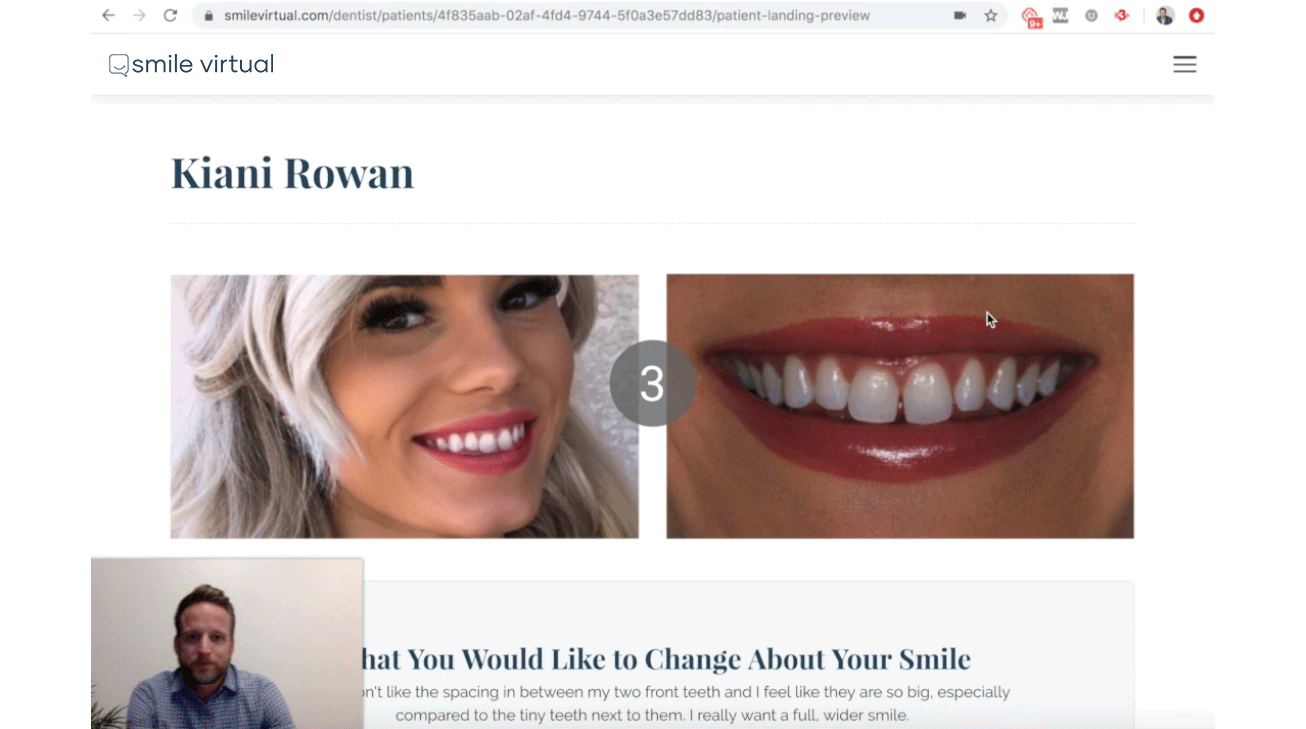 The Perfect Virtual Consult Example Video – Smile Virtual