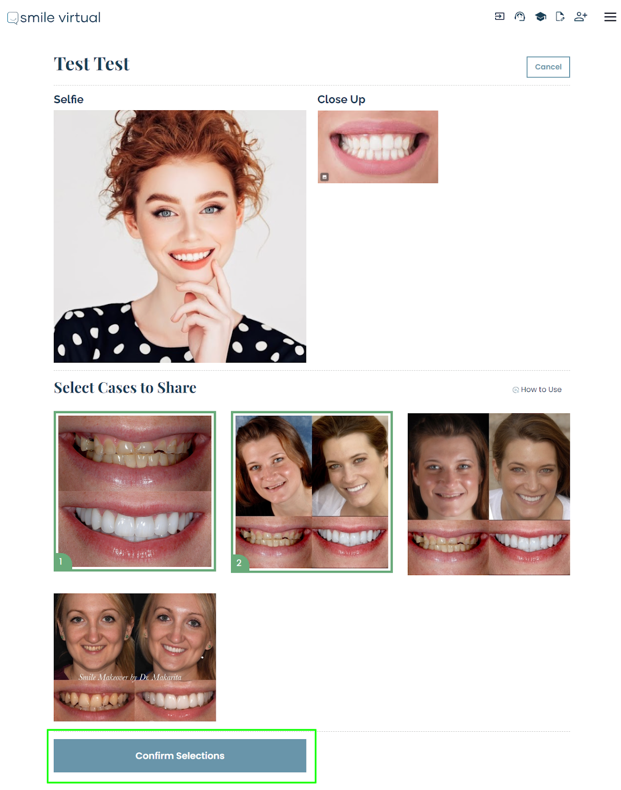 Steps To Record A Virtual Consultation – Smile Virtual